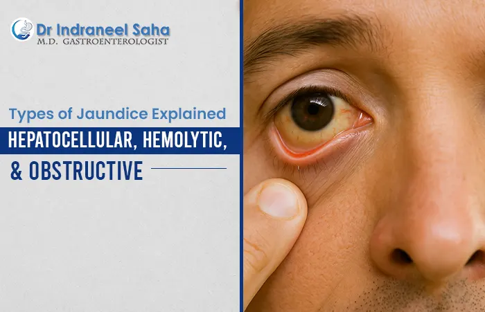 Types of Jaundice Explained: Hepatocellular, Hemolytic, and Obstructive